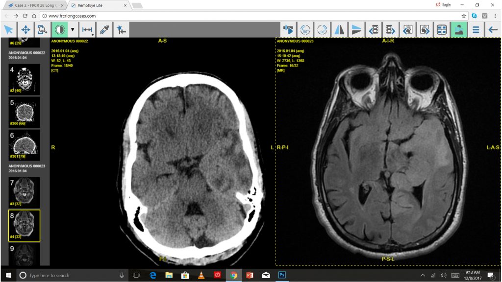 FRCR Longs - FRCR 2B Long Cases Online Exam Practice